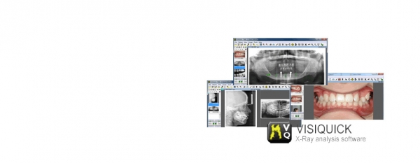 Logiciel de traitement d'images VisiQuick - UDental